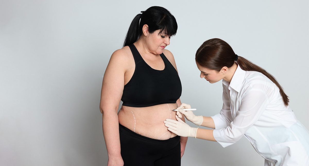 Bariatric Surgery - Medi Health Mexico