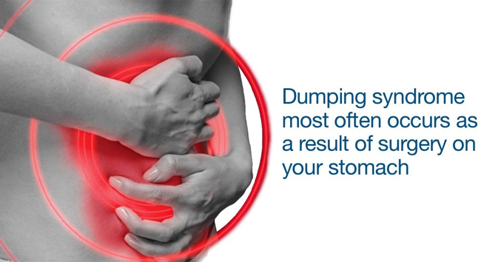 Dumping Syndrome - MediHealth Mexico