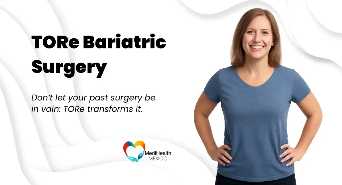 TORe Bariatric Surgery Revision | Restore Weight Loss